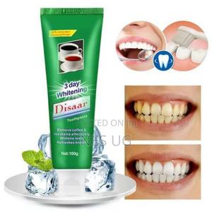 Disaar 3 Day Whitening Toothpaste Remove Stains Fresh Breath in Central ...