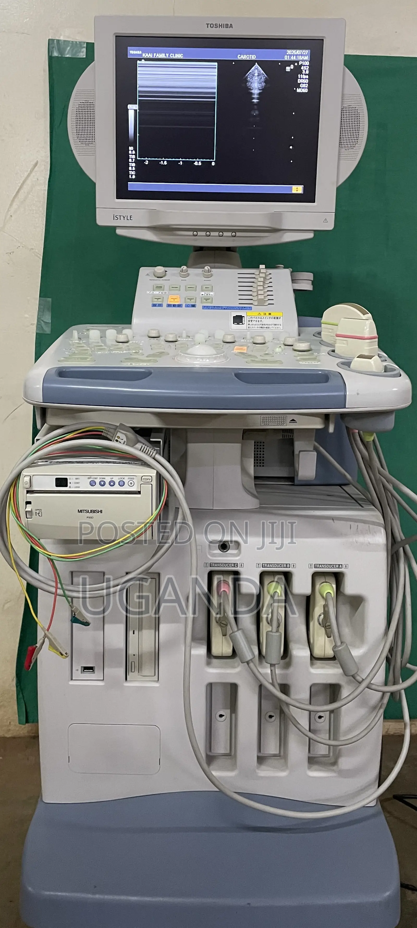 Toshiba Nemio Xg Ssa-580a – Ultrasound System in Central Division ...